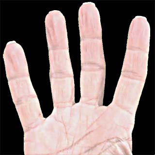 The main cutaneous folds on the human body