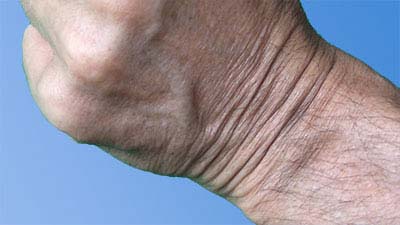 The main cutaneous folds on the human body
