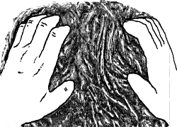 Human hair; from folds in the scalp to baldness